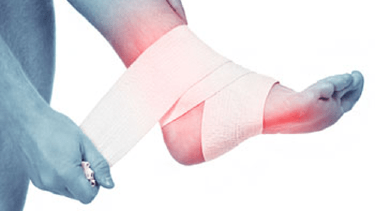 ¿Qué es el Vendaje Funcional? | MOV Rehabilitación